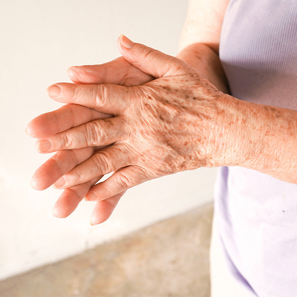 How to Treat Age Spots on Hands - The BodyFirm